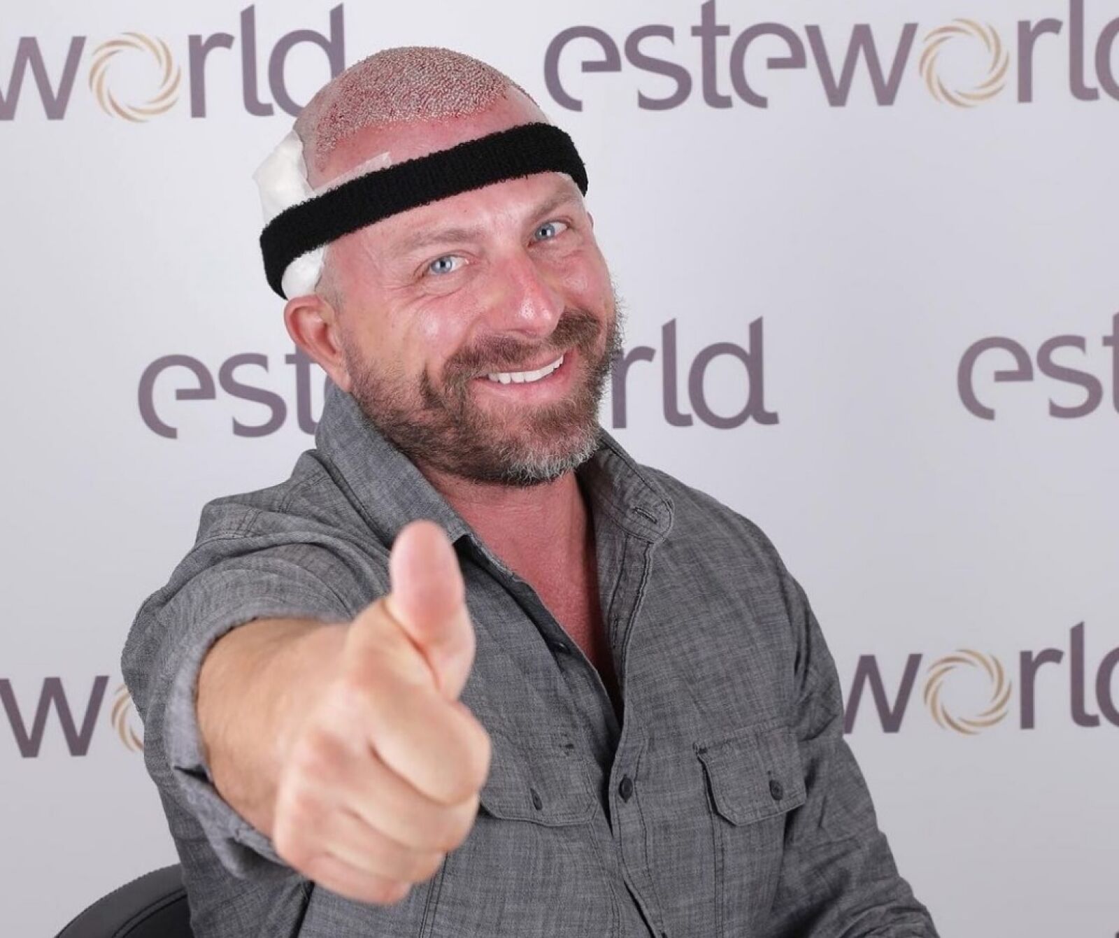 Beste haargroeimiddelen